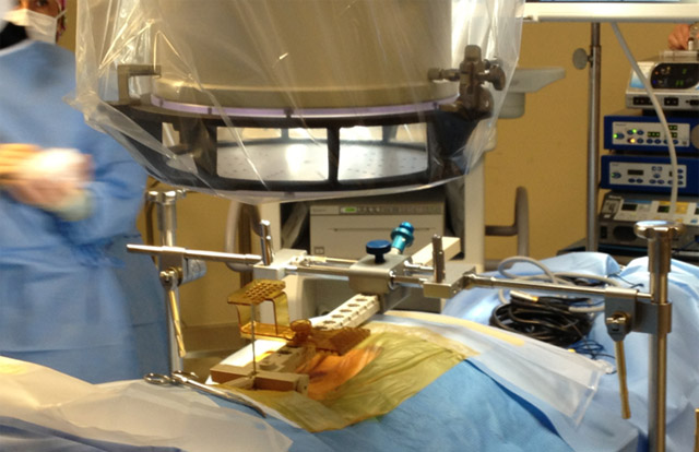 Robotics Endoscopic Spine Surgery — Lucia Zamorano, MD, PLC